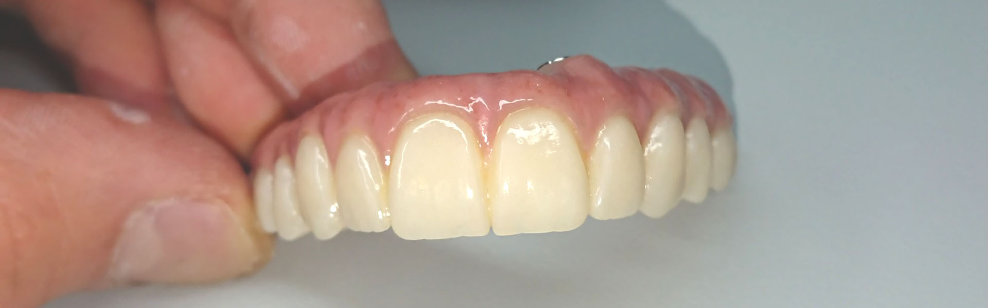 Fixní protetika - Lab4dent